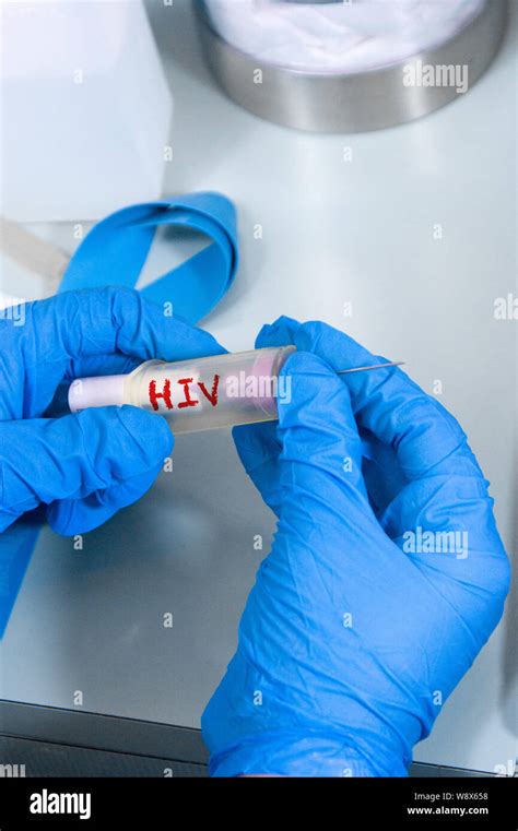 Hiv Test Brussels At Neal Ching Blog