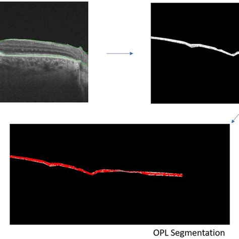 Illustrates The Segmentation And Cropping Of The Outer Plexiform Layer Download Scientific