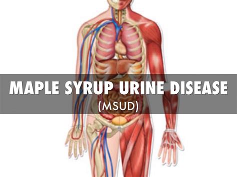 Trigger Maple Syrup Urine Disease Principles In Biochemistry