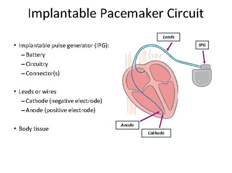 Cardiac Pacemaker Pacemaker Circuit Diagram Northside Heart