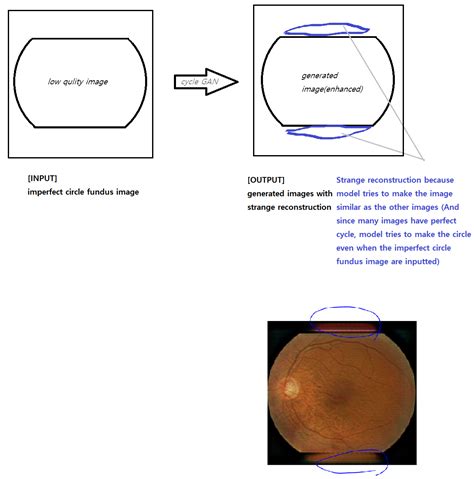 Dataset Did You Use All The Eyeq Data Issue Qtacierp Isecret Github