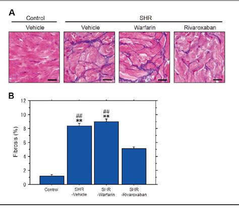 Collagen Volume Fraction In The Atrium Study 2 A Representative