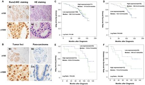 The Significance Of Runx2 Mediating Alcohol Induced Brf1 Expression And Rna Pol Iii Gene