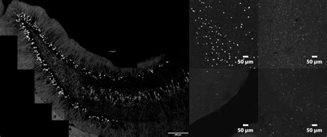 Quantification Of C Fos Positive Neurons In Mouse Brain Sections Using Truai™ Deep Learning