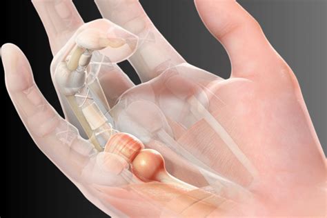 Trigger Finger Symptoms Causes And Treatment In Ahmedabad Krisha Hospital