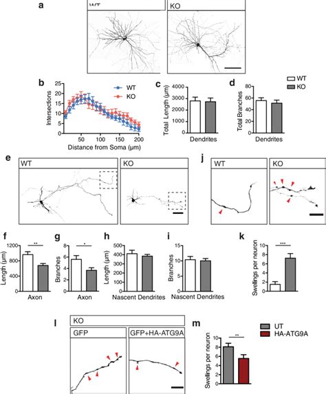 Axon Specific Defects In Ap4e1 Ko Neurons A Cultured Gfp Filled Download Scientific Diagram