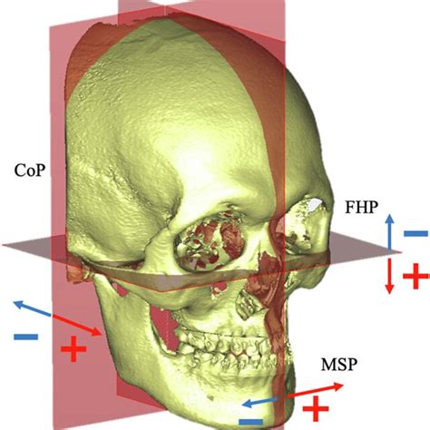Kernahan And Stark S Classification Download Scientific Diagram