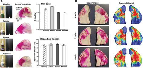 Nasal Sprays A In Vitro Tests Of Nasal Sprays Plumes Deposition