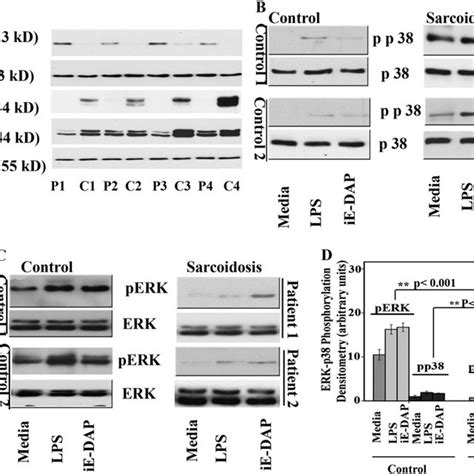 Effect Of Nucleotide Binding Oligomerization Domain 1 Nod 1 And