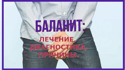 Баланит диагностика причины лечение Youtube