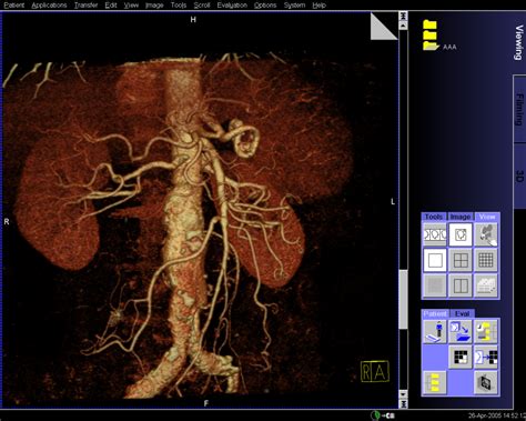 Radiodiagnostik Pemula CT Scan