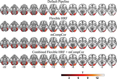 task related neural activity at time 1 plotted values represent