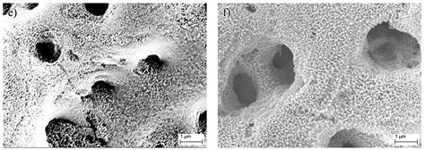 Ti Based Biomedical Material Modified With Tioxtinx Duplex Bioactivity Film Via Micro Arc
