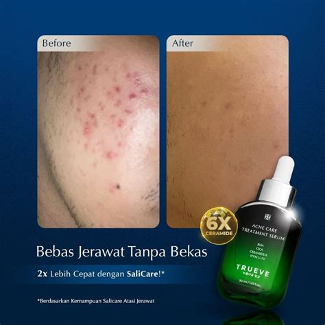 Melalui The Journey To 100 Synergistic Barrier 100 Truemate Buktikan Efektivitas Produk Produk