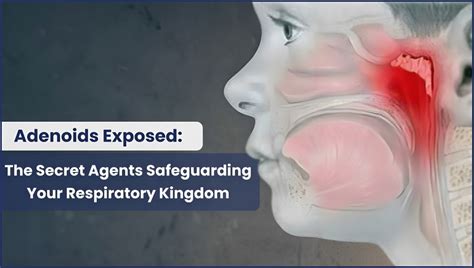 Location Of Adenoidsthe Structure Of The Nasopharynx