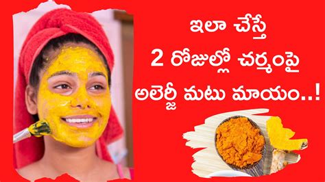 Turmeric Allergy On Skin At Adela Spooner Blog