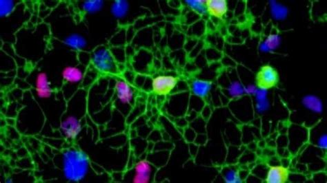 ‘master Switch For Myelination In Human Brain Stem Cells Identified