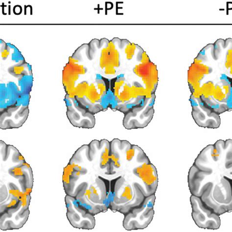 Striatal Activation For Each Of The Six Fmri Contrasts Including Download Scientific Diagram
