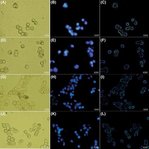 Dapi Staining Assay For Detection Of Chromatin Decomposition In Mcf 7 Download Scientific