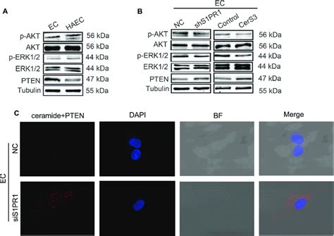 A Reduction In Ceramide Levels And Its Interaction With Pten Activates Download Scientific