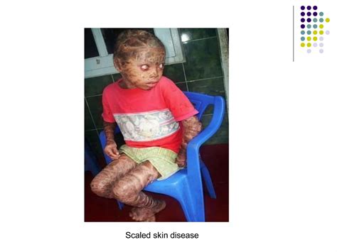 Staphylococcus Spp Pptx