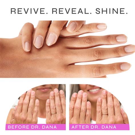 Why Are My Nails Separating Everything You Need To Know About Onychol