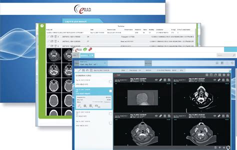 17 Best Radiology Software Tools Reviewed For 2026