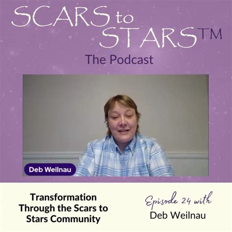 The Realize Foundation On Linkedin Deborah Weilnau Talks About Her Journey Through The Scars To
