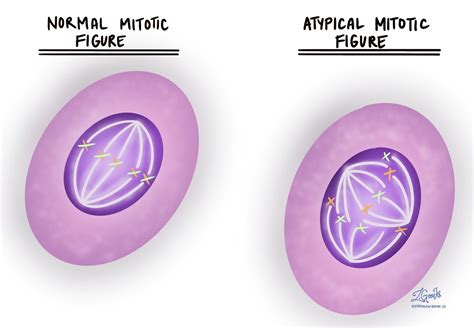 Atypical Mitotic Figure Mypathologyreport