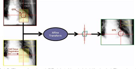 Figure 1 From An Optimization Algorithm For 3d Real Time Lung Tumor