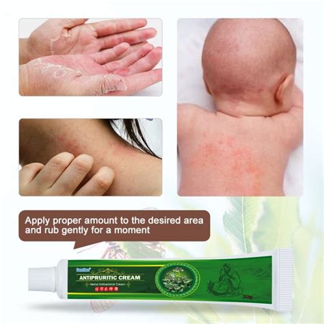 Sumifun Eczema Treatment Cream Gamot Sa Kati Kati Sa Balat Ointment For Itchy Skin And Allergy
