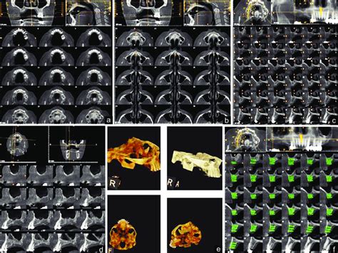 a f routine sequential cone beam computed tomography scans a and b