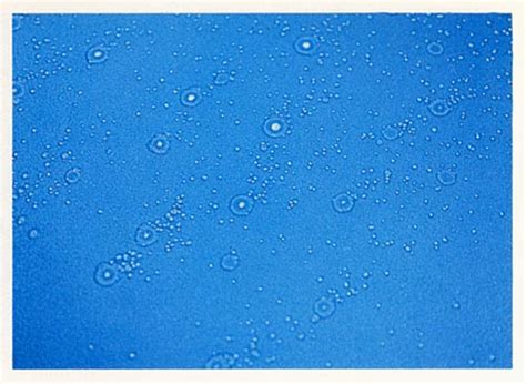 What Causes Fish Eyes In Epoxy