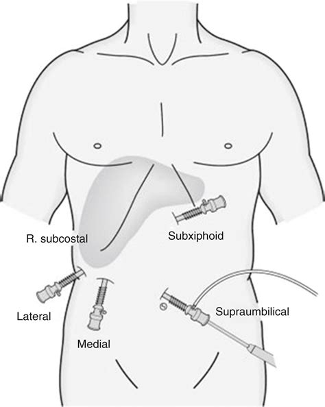 Benign Gallbladder And Biliary Tree Clinical Tree