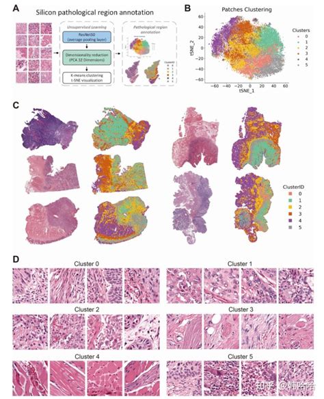 文献解读 头颈部鳞状细胞癌的预后模型 转录组 单细胞 空间组 病理组学 知乎