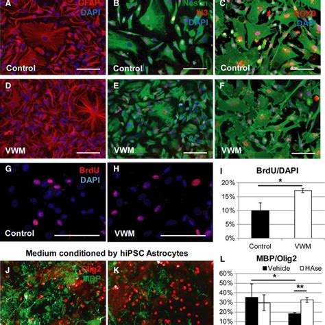 Human Induced Pluripotent Stem Cell Ipsc Derived Astrocytes Confirm A