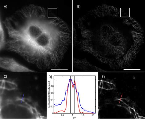 lateral resolution gain estimating the resolution gain in the