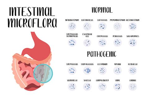 장 내 미생물 위장 창 자 창 자에 대 한 정상 및 병원 성 박테리아 좋은 나쁜 미생물 미생물군유전체 벡터 플랫 만화 일러스트레이션 전단지 의료 브로셔 배너에 적합 마이크로