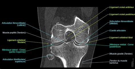 Rotule Du Genou Illusrotule3 Clinique Du Sport