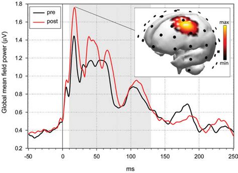 Responses To TMS Before And After Hz Conditioning Total Activation Download Scientific
