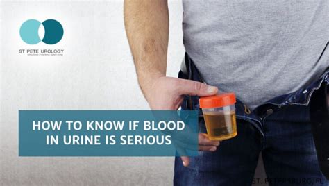 How To Know If Blood In Urine Is Serious St Pete Urology