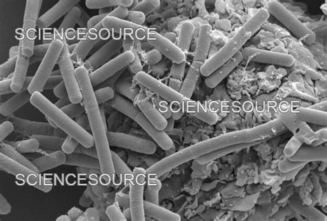 E Coli And Macrophage Under A Micros Stock Image Science Source
