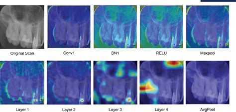 Figure 1 From Visualization Of Layers Within A Convolutional Neural Network Using Gradient