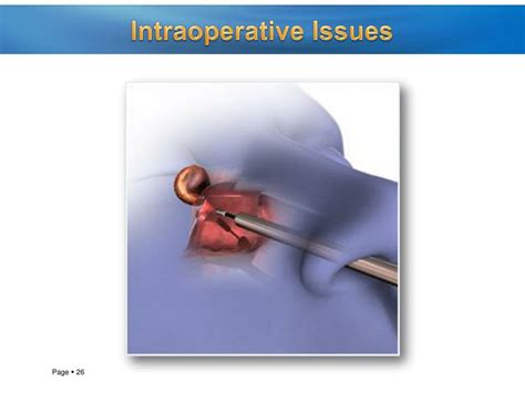 Ppt Anesthesia For Transphenoidal Hypophysectomy Powerpoint Presentation Id 611933