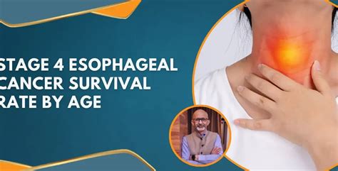 Stage 4 Esophageal Cancer Survival Rate By Age Detroit Chinatown