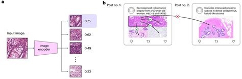 A Visuallanguage Foundation Model For Pathology Image Analysis Using Medical Twitter MYRIAD