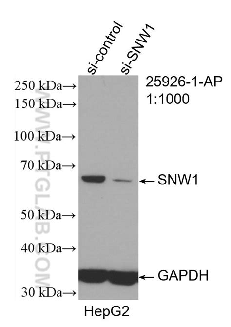 snw1 antibody 25926 1 ap proteintech