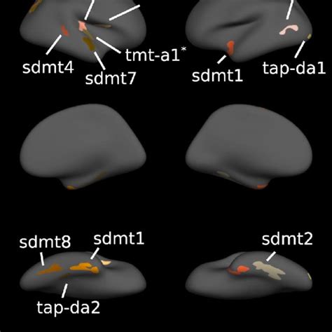 Cortical Regions Associated With Spatial Processing Clusters Of Download Scientific Diagram