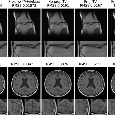 comparison of images reconstructed by use of various regularization