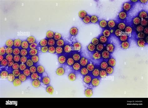Polyoma Viruses Coloured Transmission Electron Micrograph Tem Of Polyoma Viruses These